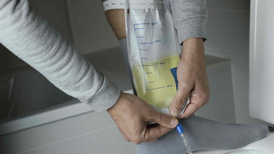 Urinveisinfeksjon ved kateterbruk - NHI.no